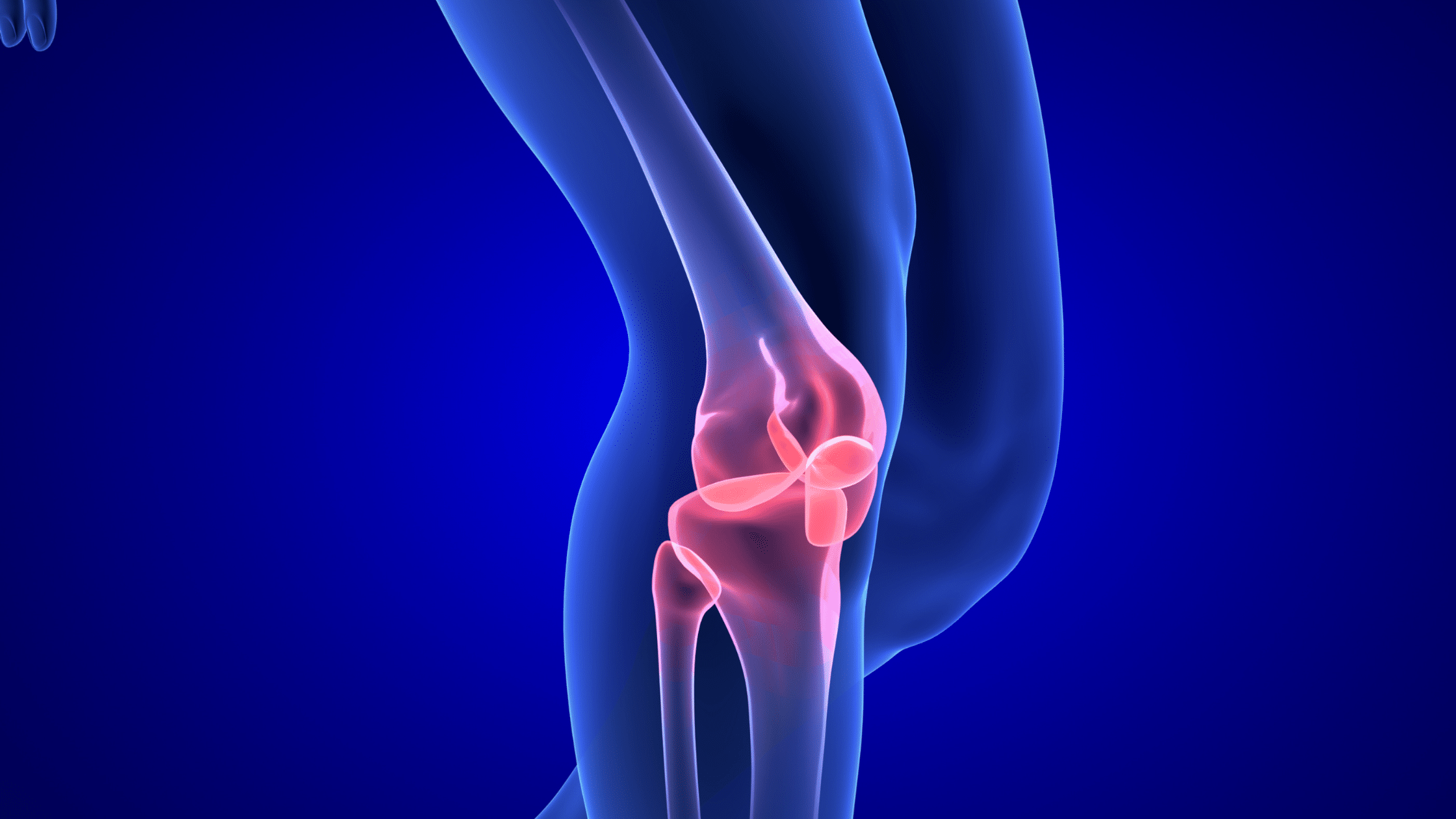 The Benefits of Shockwave Therapy for Arthritis Relief - THE ...